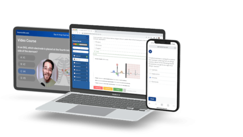 Upgrade - Smarter MA